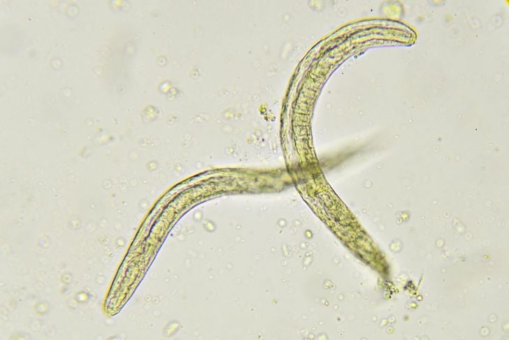 I parassiti più comuni che possono colpire gli esseri umani - Salus.it